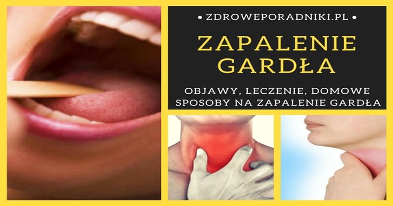 Zapalenie gardła: objawy, leczenie, domowe sposoby na zapalenie gardła