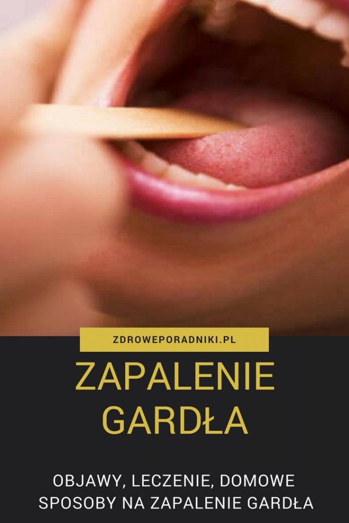 Zapalenie Gardła Objawy Leczenie Domowe Sposoby Na Zapalenie Gardła