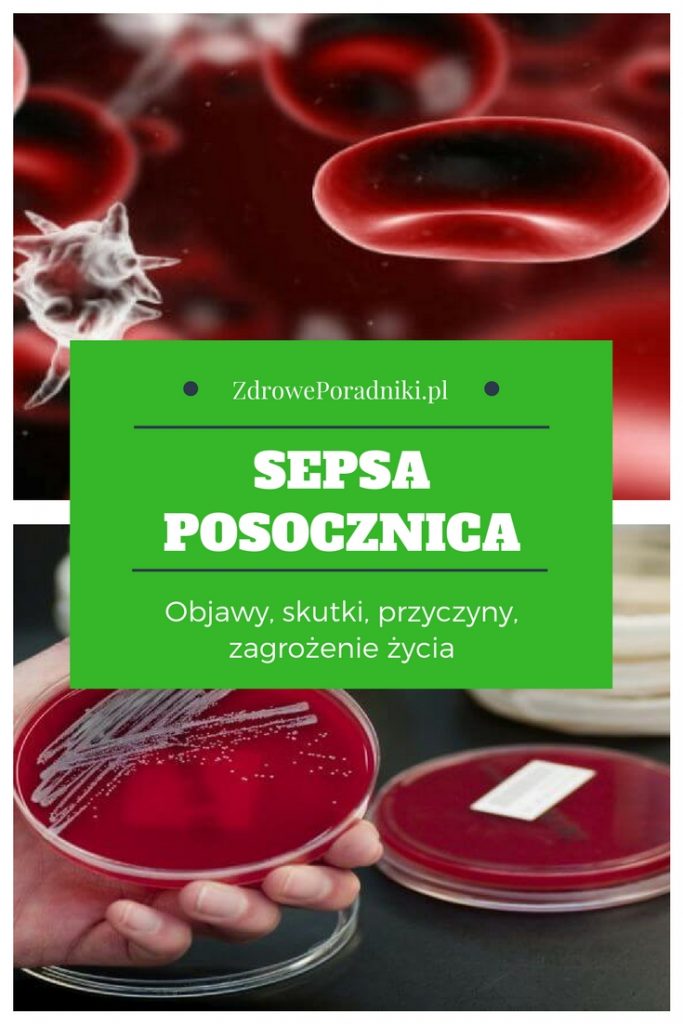 Sepsa: objawy, skutki, przyczyny, zagrożenie życia