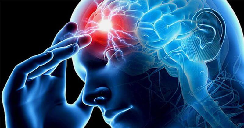 Udar mózgu. Zobacz przyczyny, objawy, diagnozę i leczenie